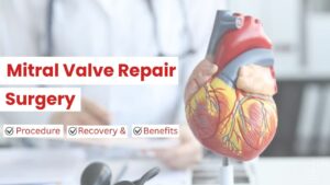 Mitral Valve Repair Surgery: Procedure, Recovery & Benefits - India ...
